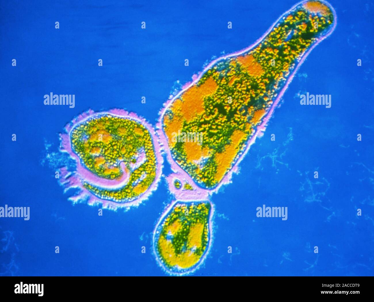 False colour transmission electron micrograph (TEM) of a thin section ...