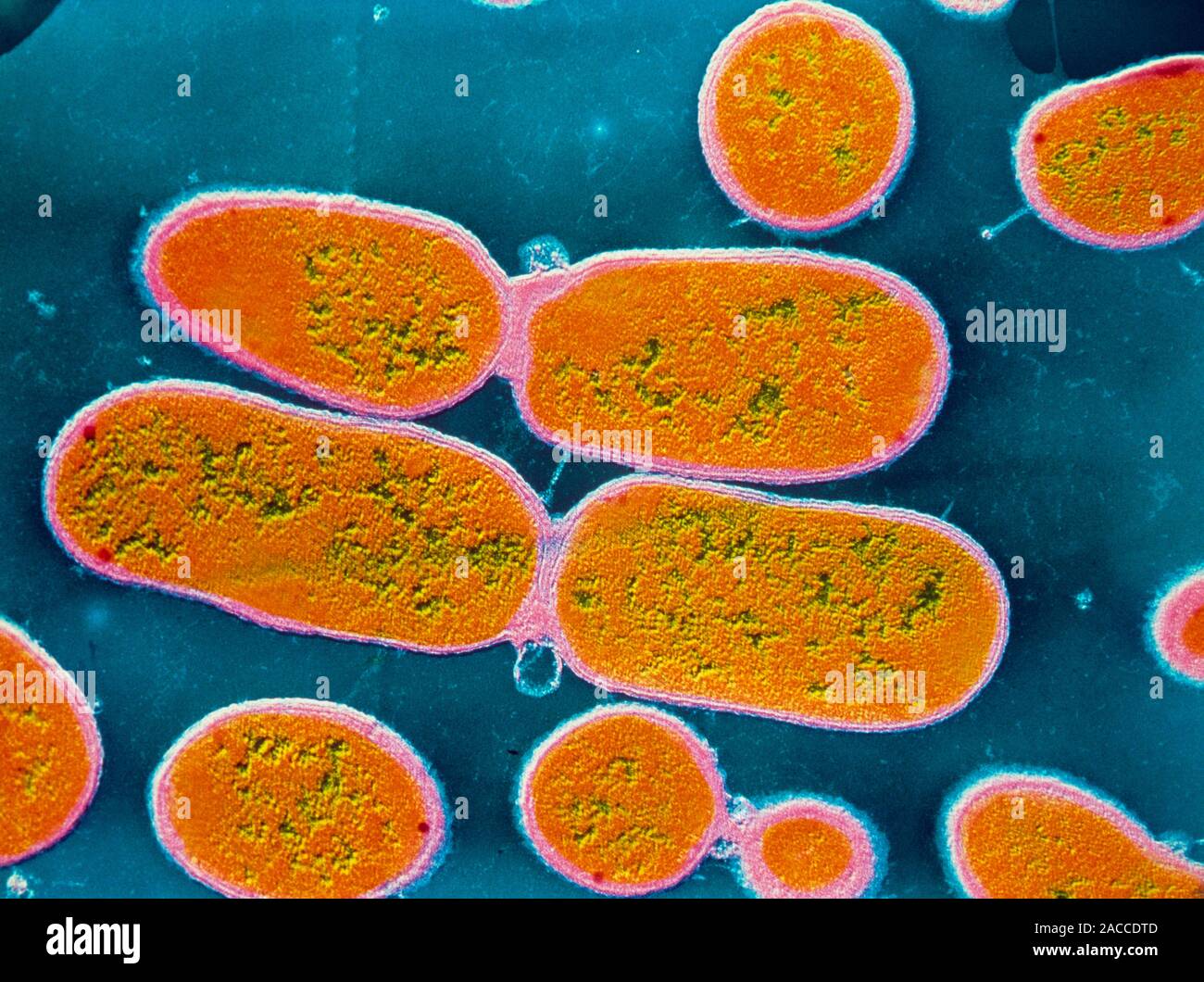False colour transmission electron micrograph of a group of the rod ...