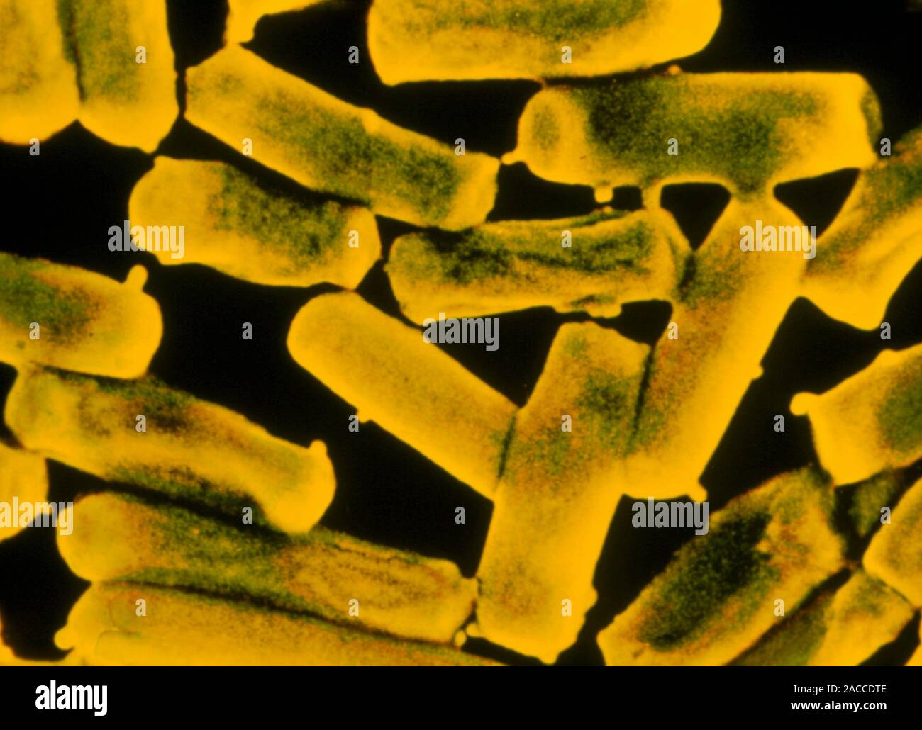 False colour scanning electron micrograph (SEM) of Clostridium ...