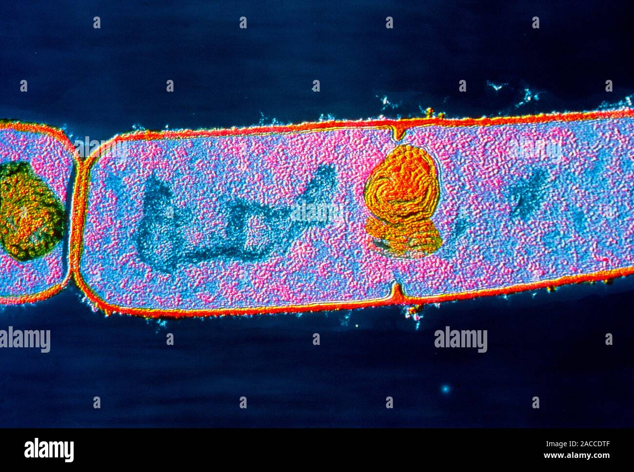 False colour transmission electron micrograph (TEM) of Bacillus ...