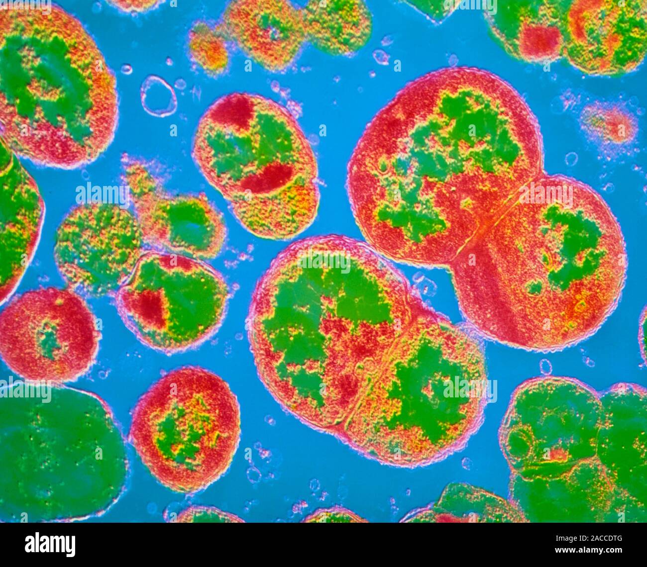 Transmission electron micrograph (TEM) of Neisseria gonorrhoeae (the ...