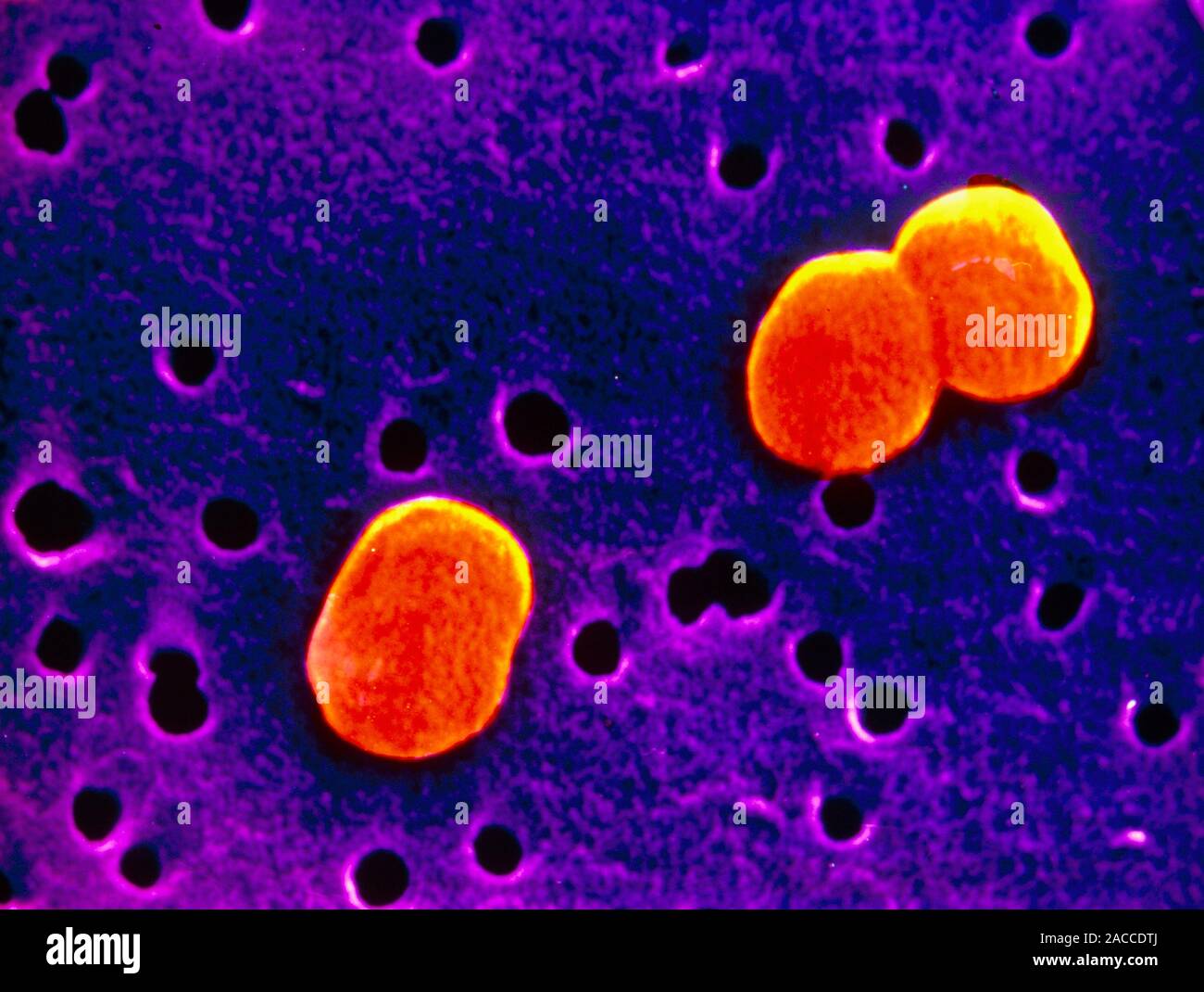 False-colour scanning electron micrograph (SEM) of Acinetobacter ...