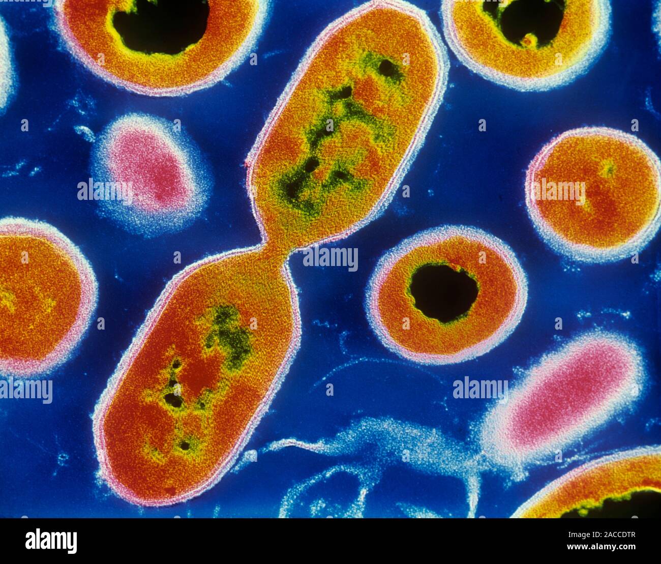 False Colour Transmission Electron Micrograph Tem Of A Colony Of Listeria Sp A Genus Of