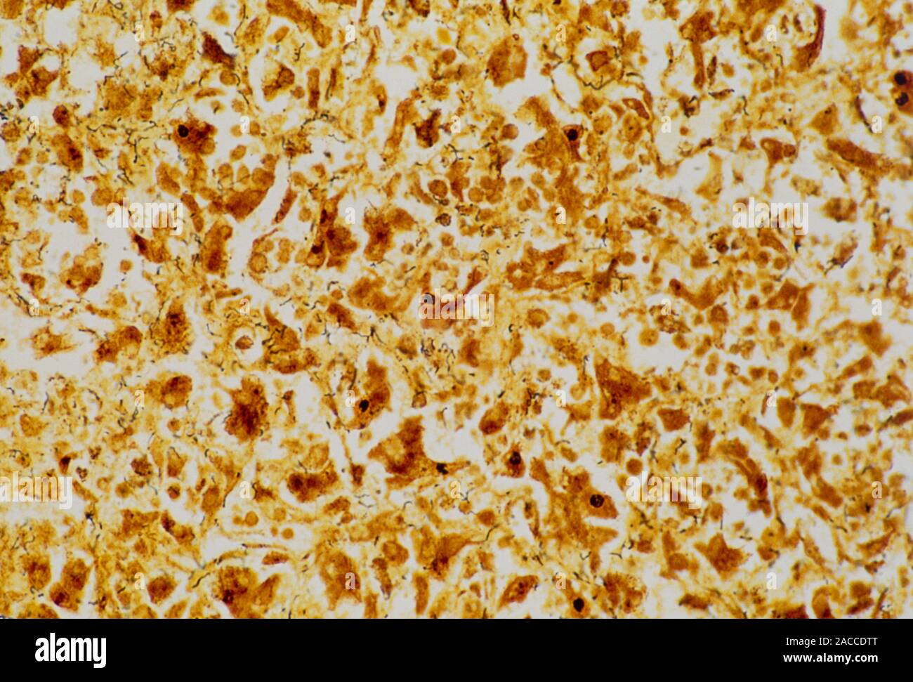 Light micrograph of the anaerobic spirochaete bacteria, Treponema ...