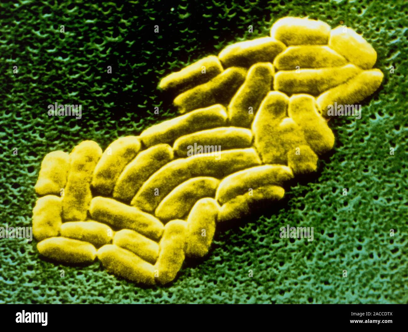 False-colour scanning electron micrograph (SEM) of a colony of ...