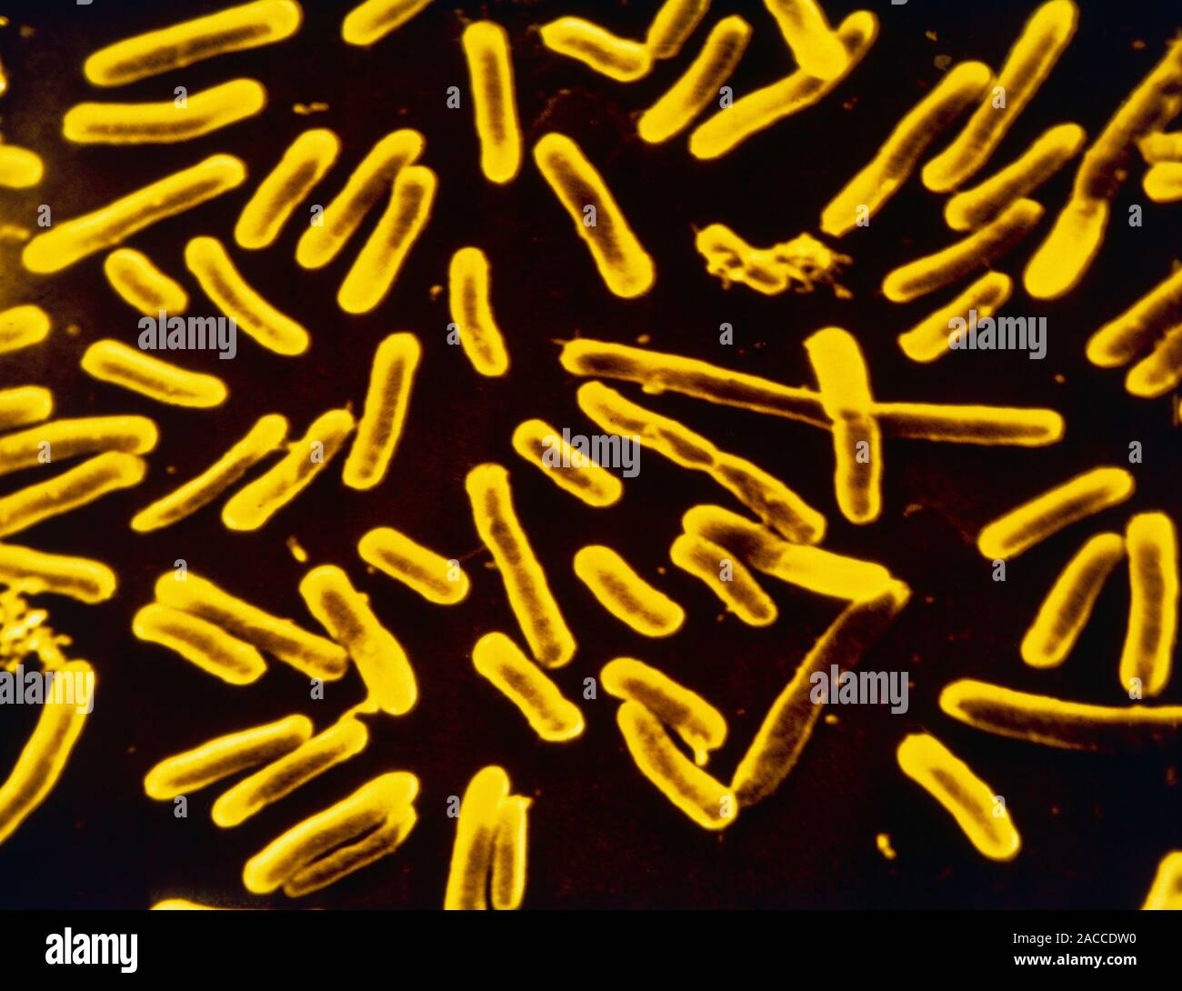 False colour scanning electron micrograph of the rodshaped bacteria ...