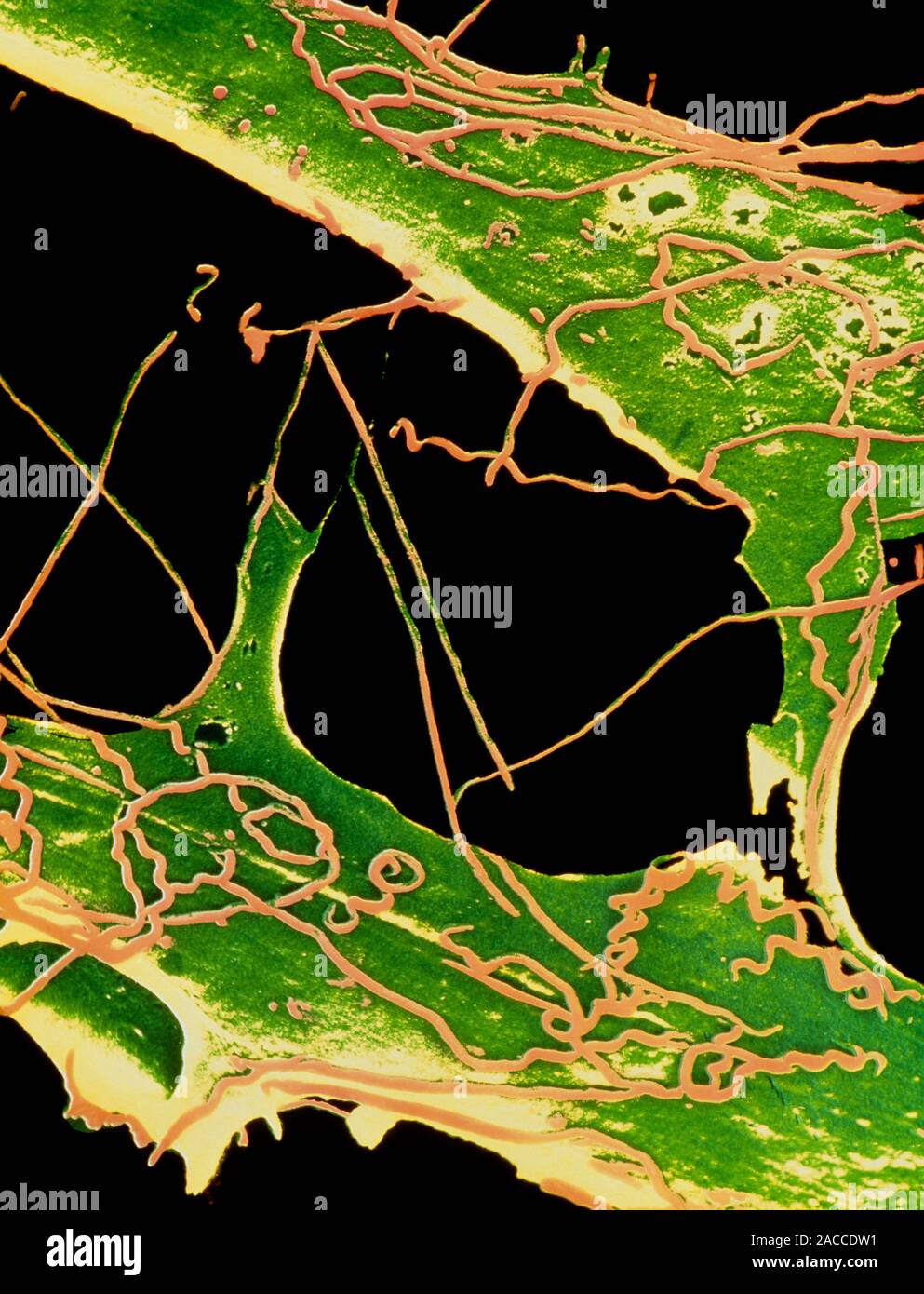 False-colour scanning electron micrograph of the anaerobic spirochaete ...