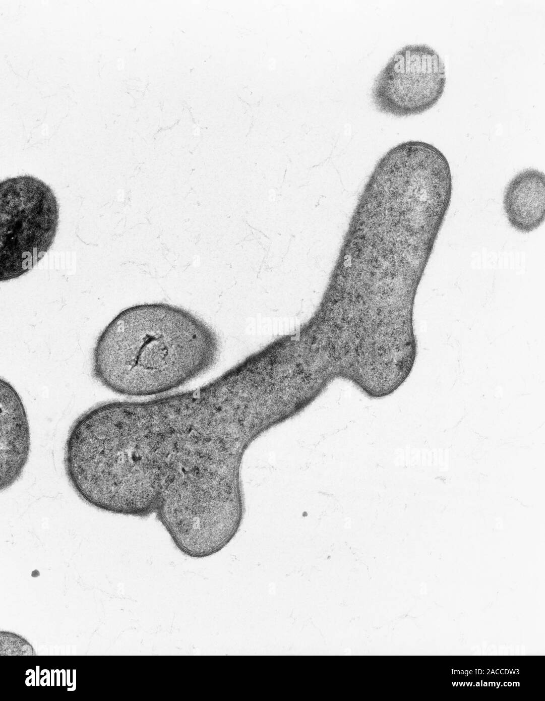 Transmission electron micrograph (TEM) of the Gram-positive, branched ...