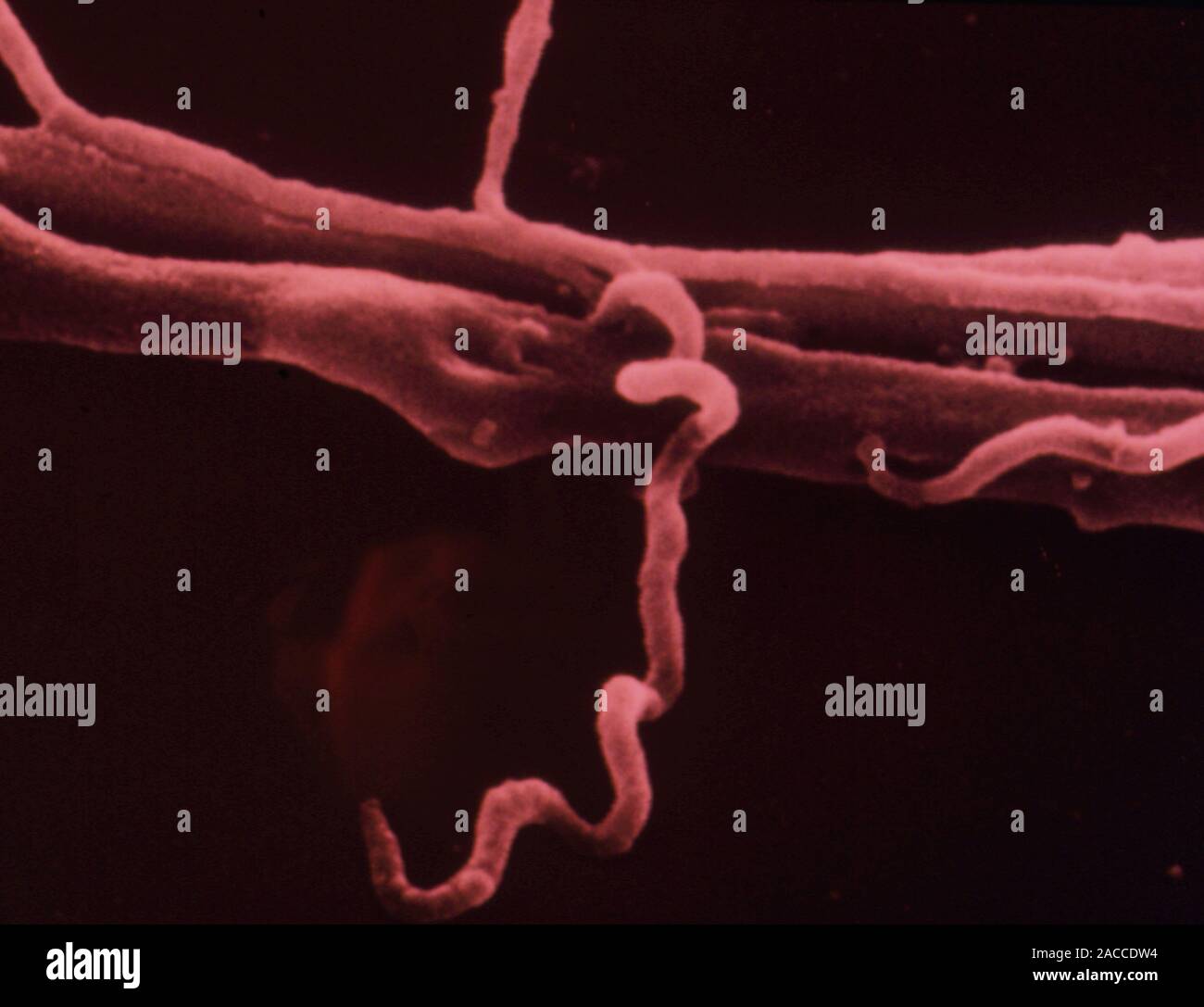 Scanning electron micrograph (SEM) showing the attachment of several ...