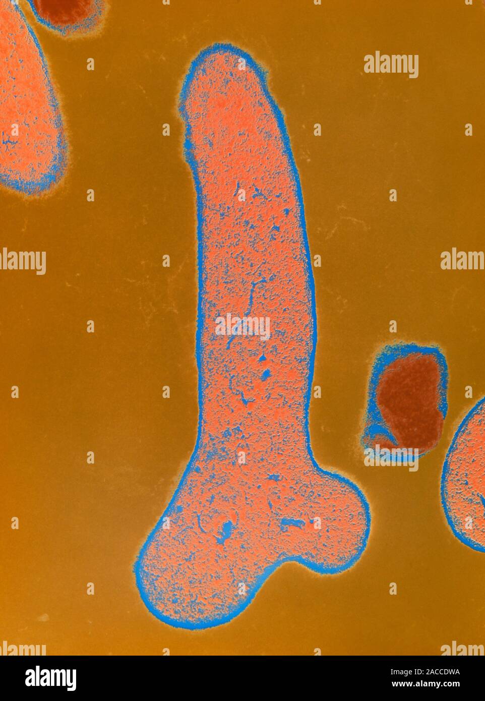 False Colour Transmission Electron Micrograph Tem Of The Gram Positive Branched Y Shaped