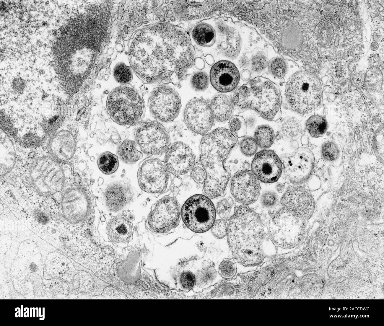 Transmission electron micrograph of Chlamydia psittaci bacteria inside ...