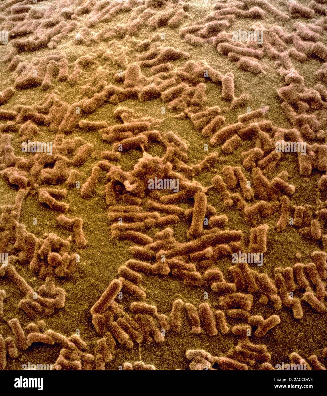False colour scanning electron micrograph (SEM) of Clostridium ...