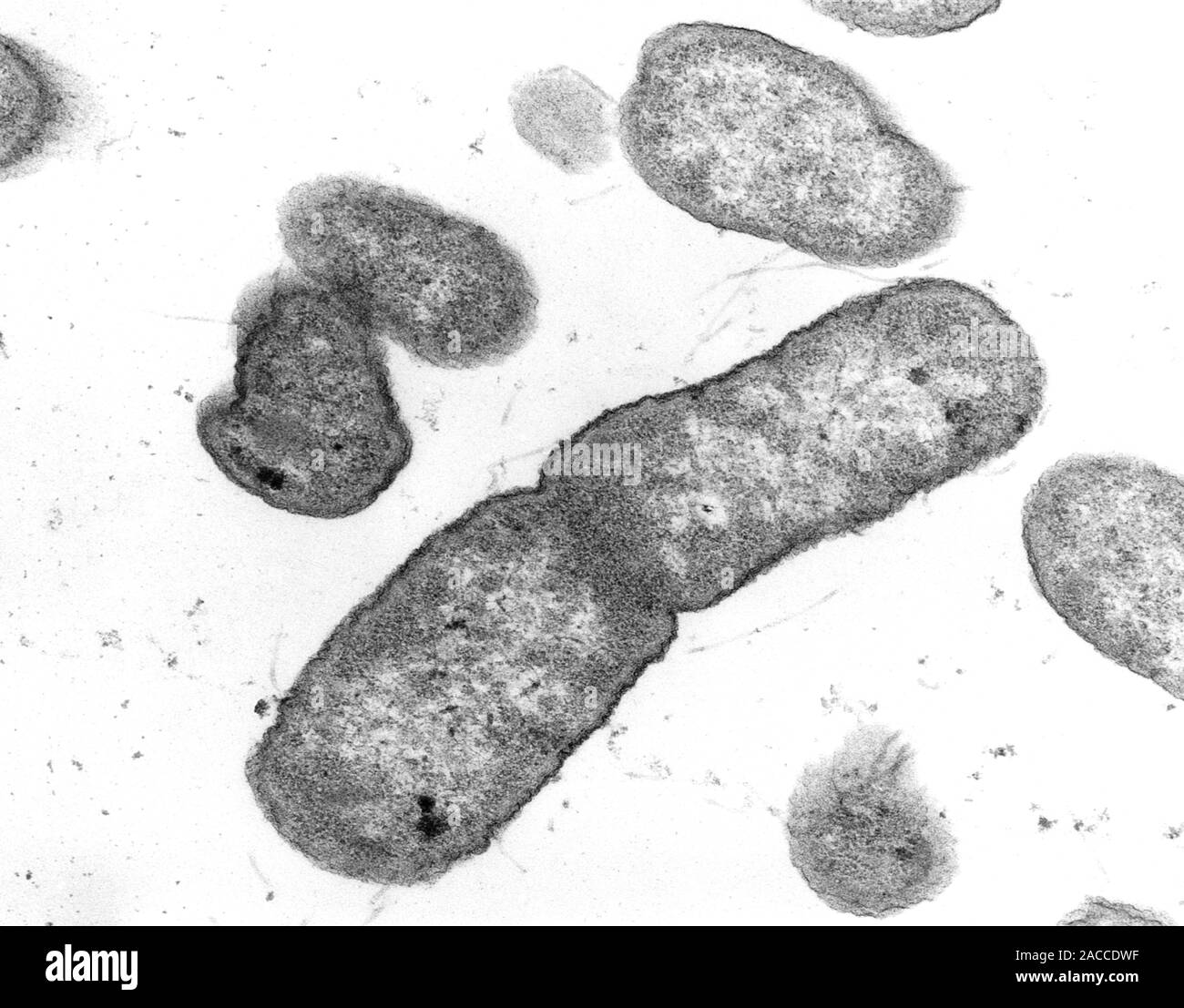 Transmission electron micrograph of the bacteria Salmonella typhimurium ...