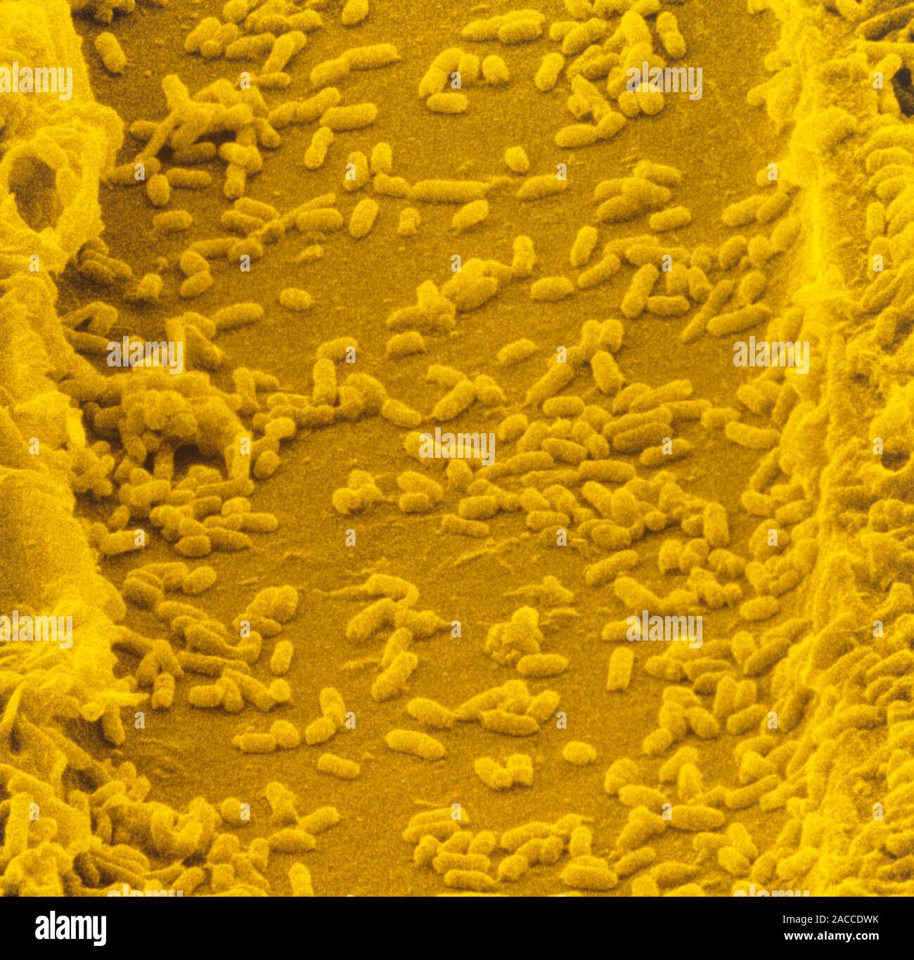 False colour scanning electron micrograph of the rod- shaped bacteria ...