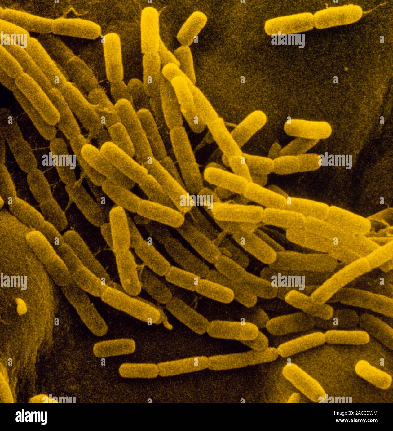 False colour scanning electron micrograph of Bacillus cereus, a species ...