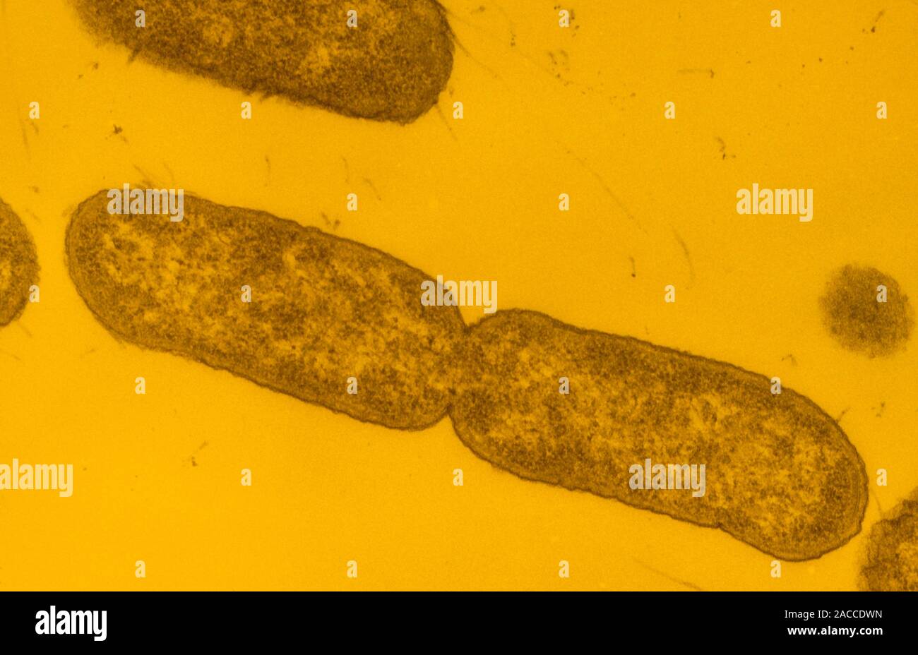 False colour transmission electron micrograph of the bacteria ...