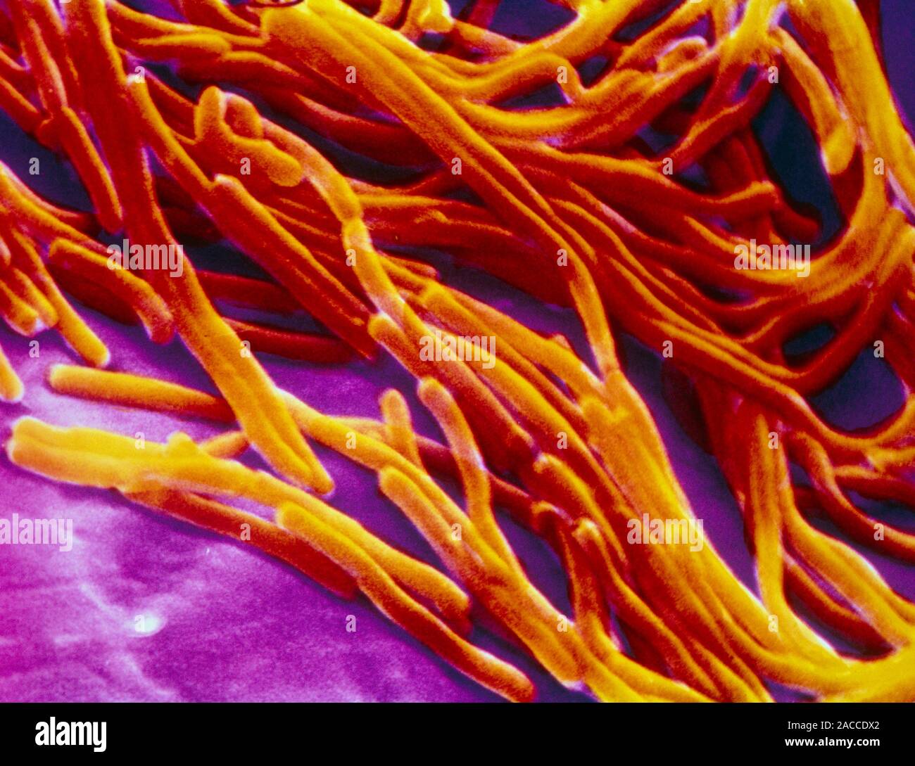 Erysipelothrix rhusiopathiae. Coloured scanning electron micrograph of ...