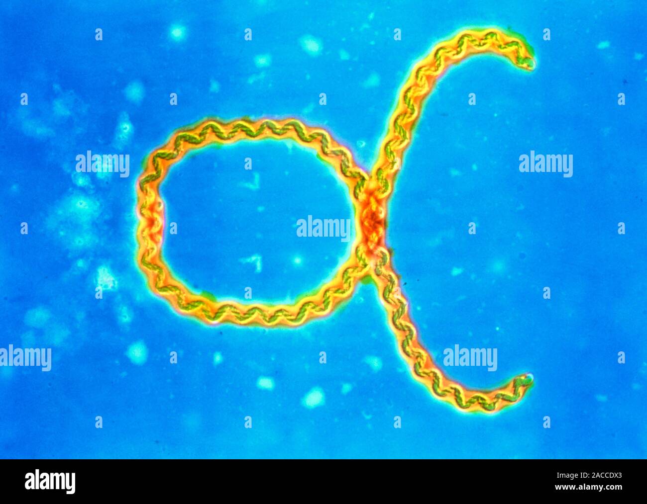 False-colour transmission electron micrograph of a Leptospira sp ...