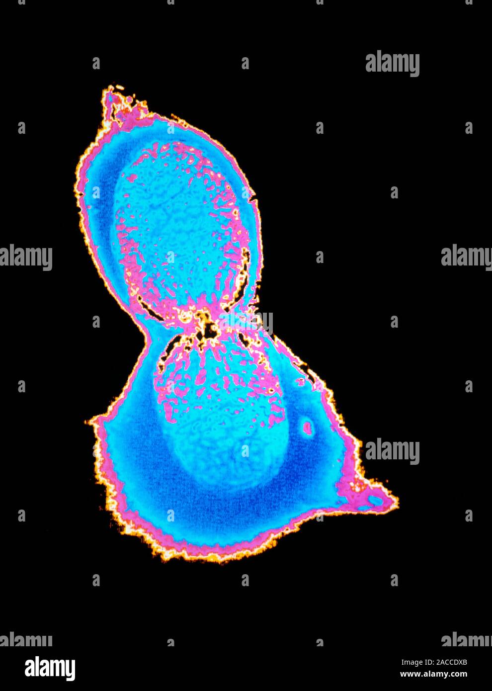 Shigella flexneri. False colour transmission electron micrograph of the ...