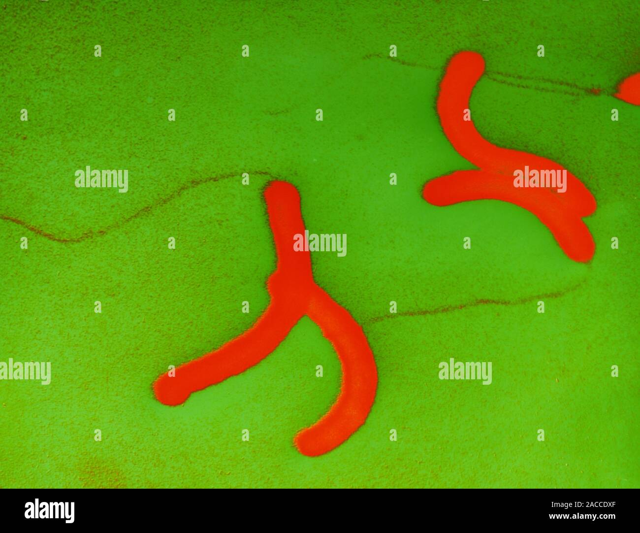False-colour scanning electron micrograph (SEM) of the comma- shaped ...
