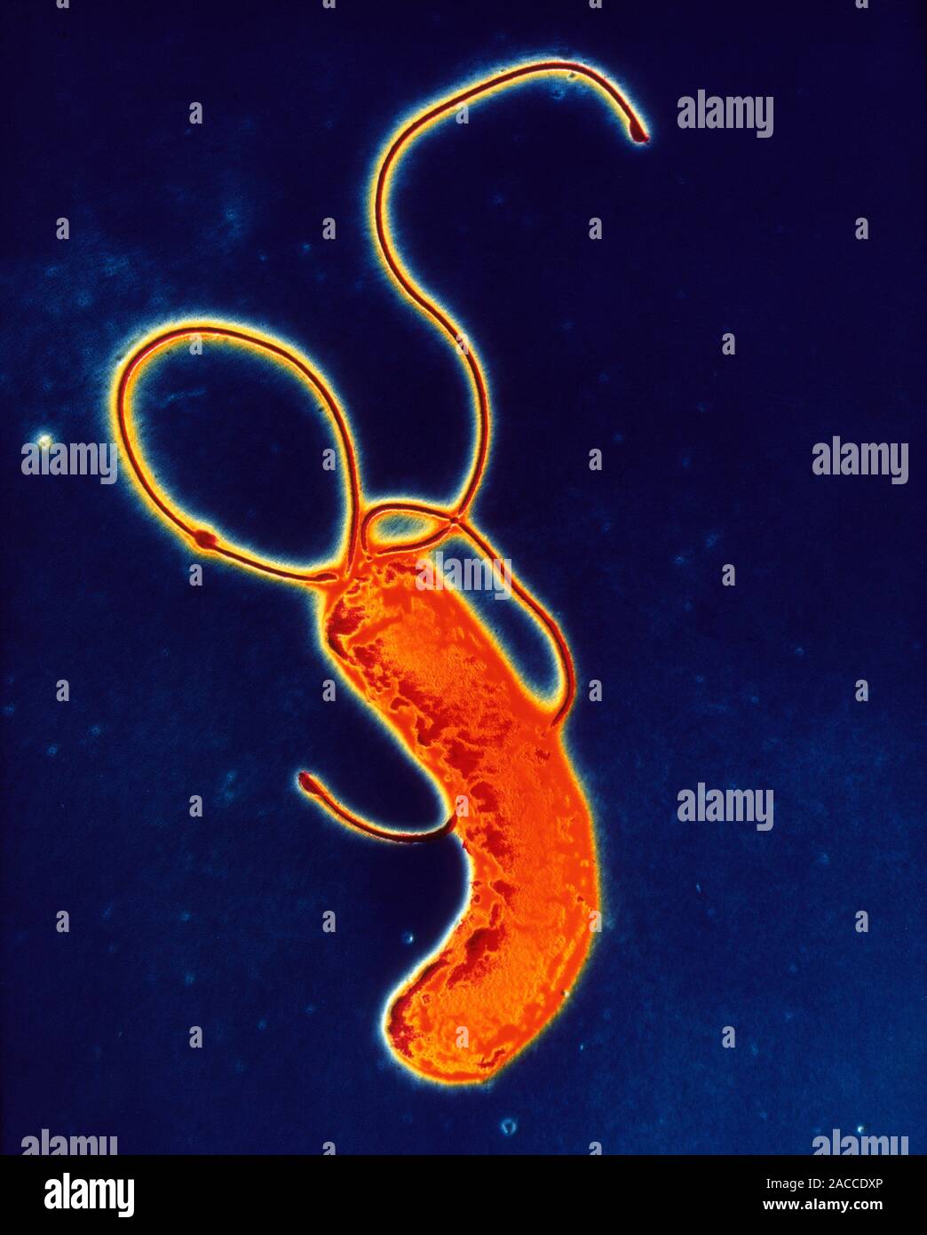 Transmission electron micrograph (TEM) of the bacterium Helicobacter ...