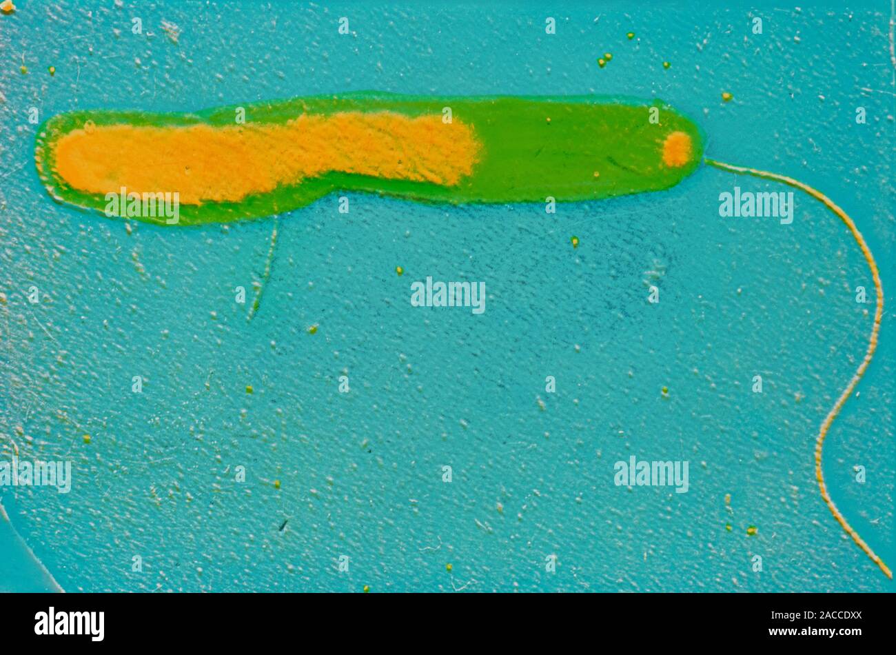False-colour transmission electron micrograph of the bacterium Vibrio ...