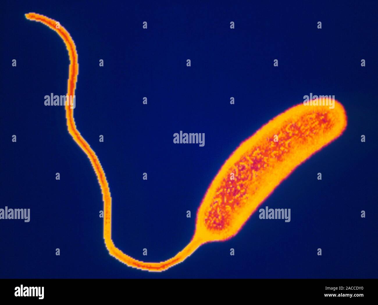False Colour Transmission Electron Micrograph Tem Of The Gram Negative Bacterium Vibrio