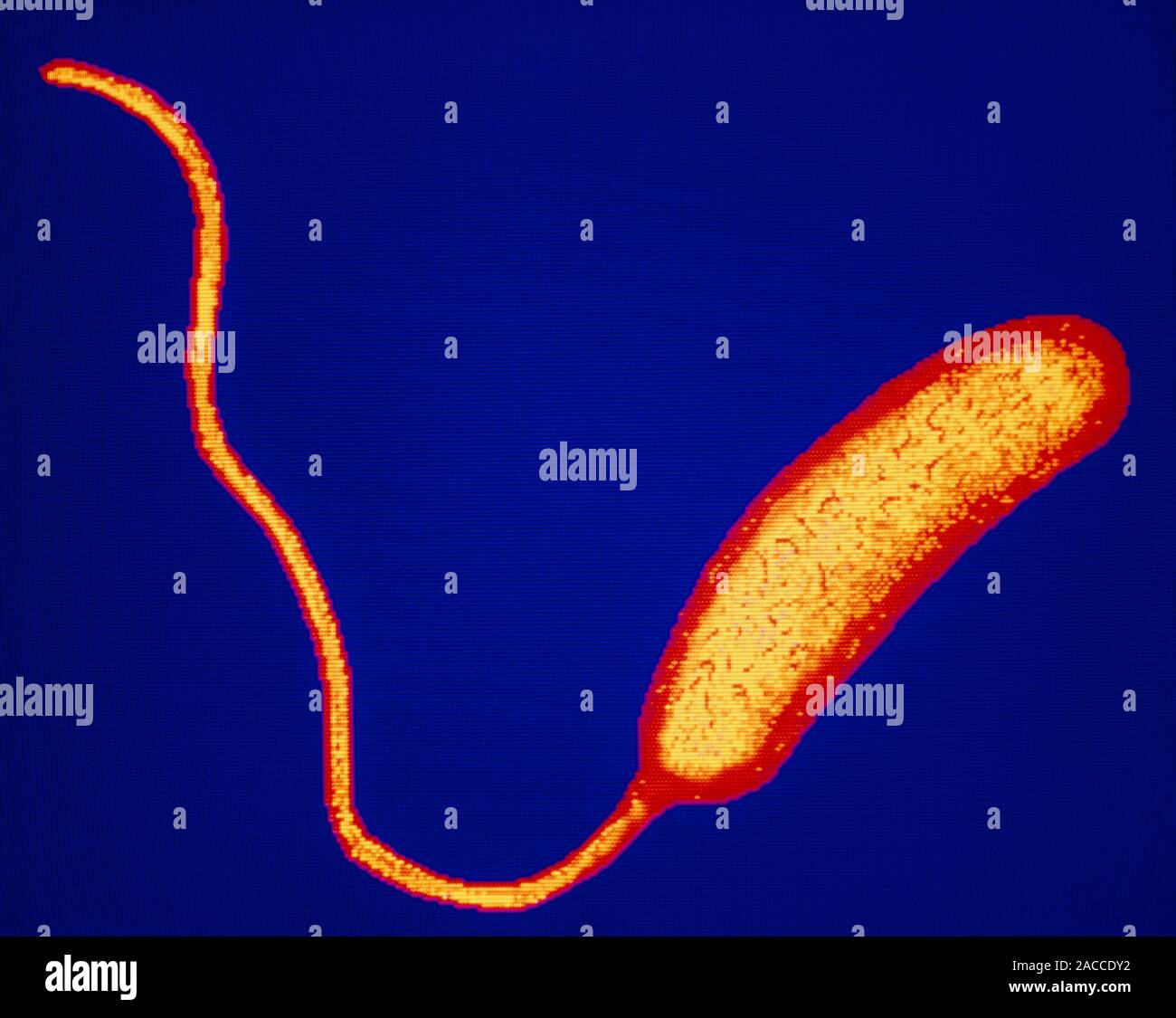 False-colour transmission electron micrograph (TEM) of the Gram ...