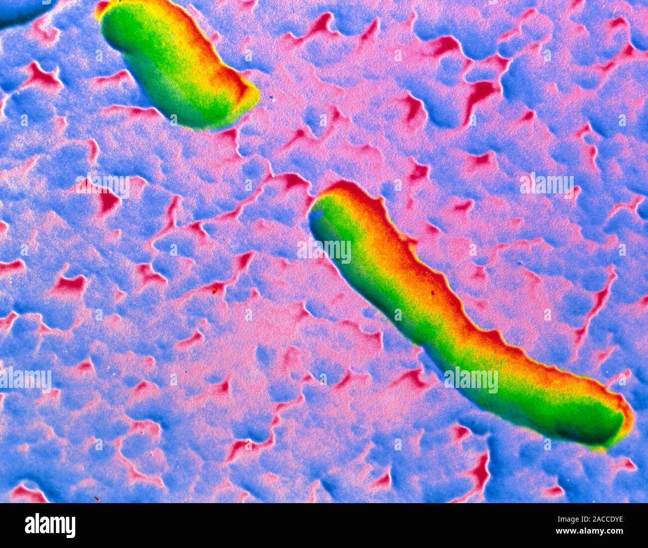False-colour scanning electron micrograph (SEM) of Haemophilus ...
