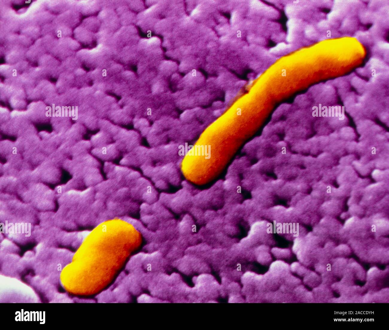 False-colour scanning electron micrograph (SEM) of Haemophilus ...