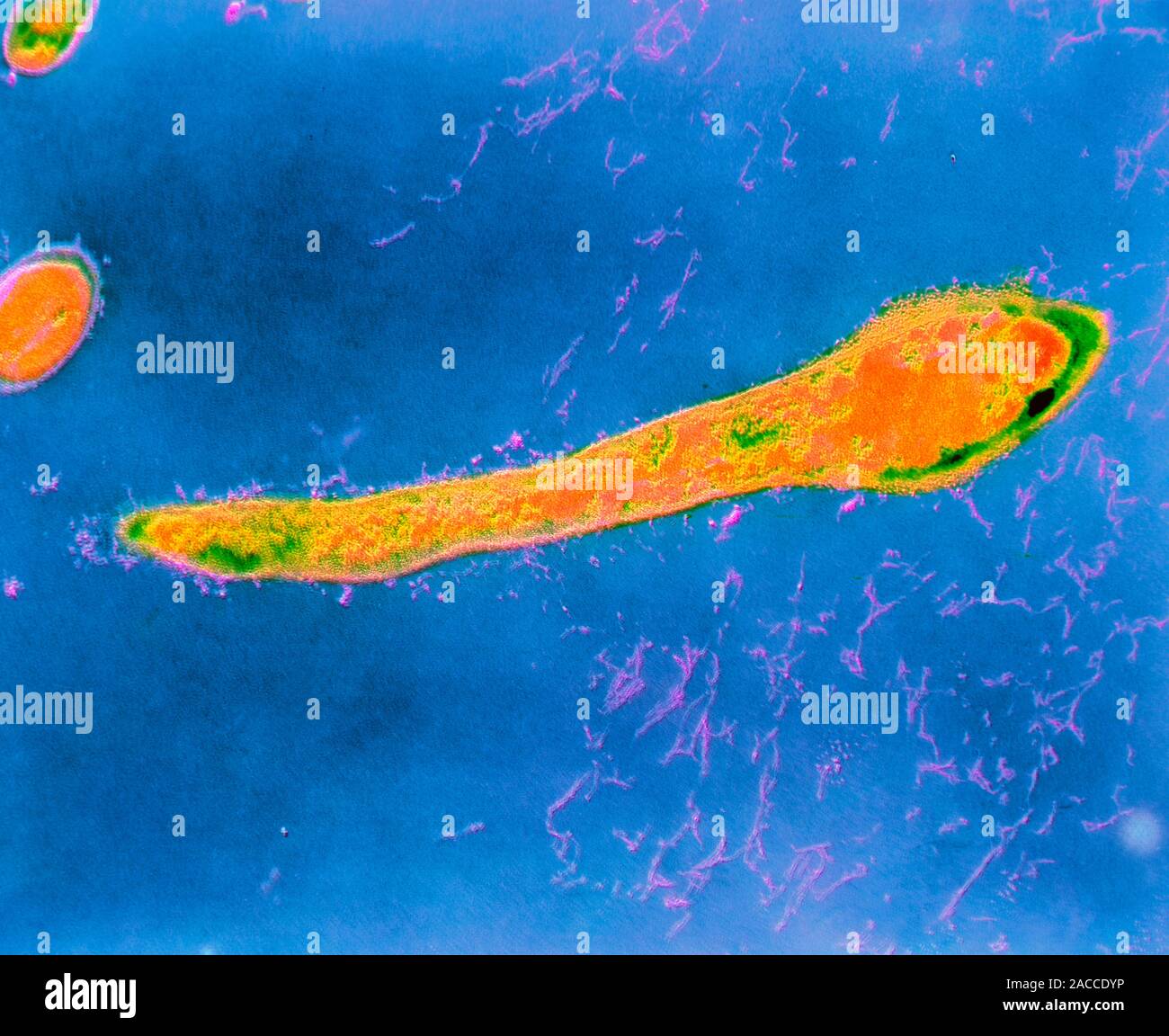 False-colour transmission electron micrograph (TEM) showing a single ...