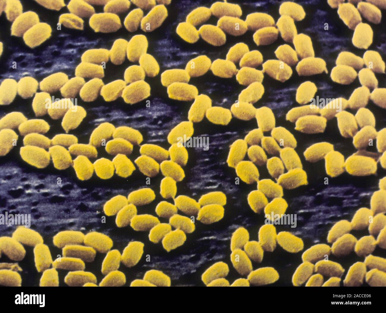 False-colour scanning electron micrograph of spores of the large, rod ...
