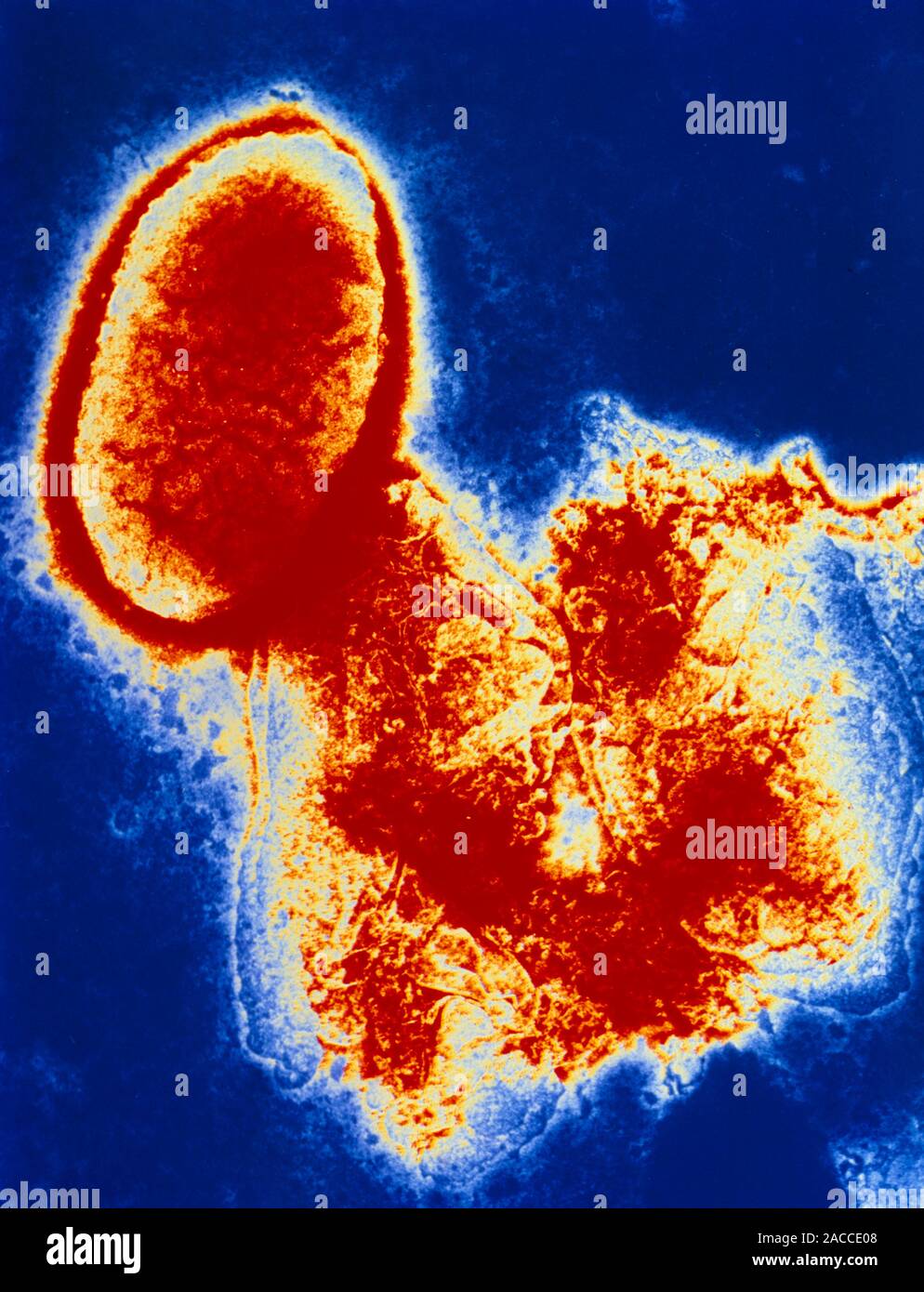 False-colour transmission electron micrograph of the bacterium ...