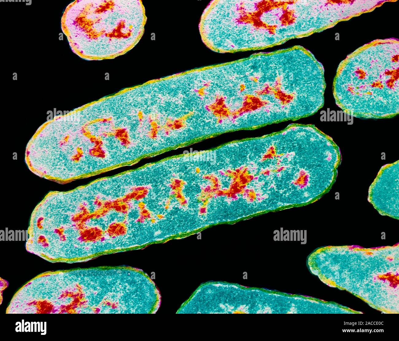 False-colour transmission electron micrograph of the bacteria ...