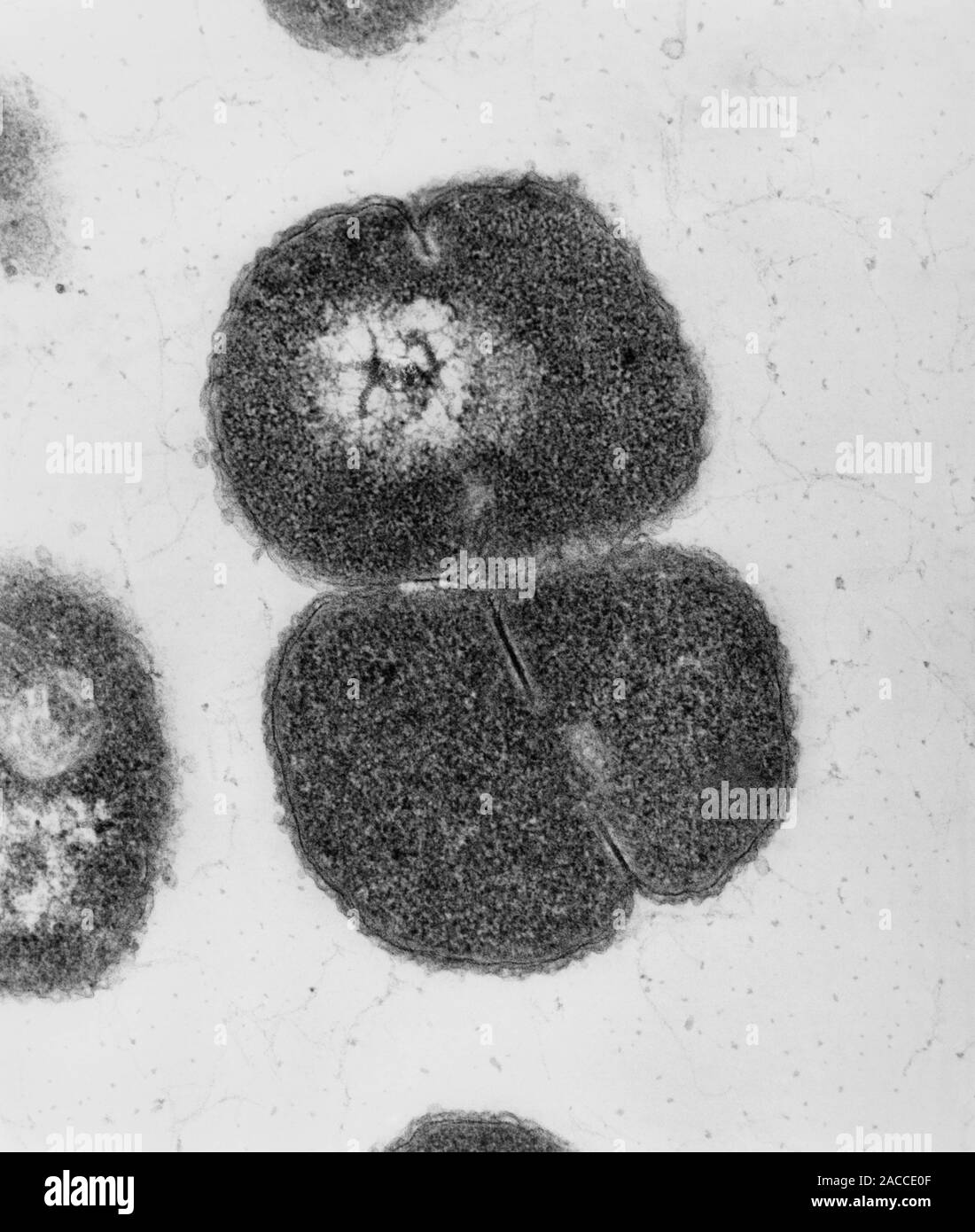 Transmission electron micrograph of Neisseria meningitidis, a spherical ...