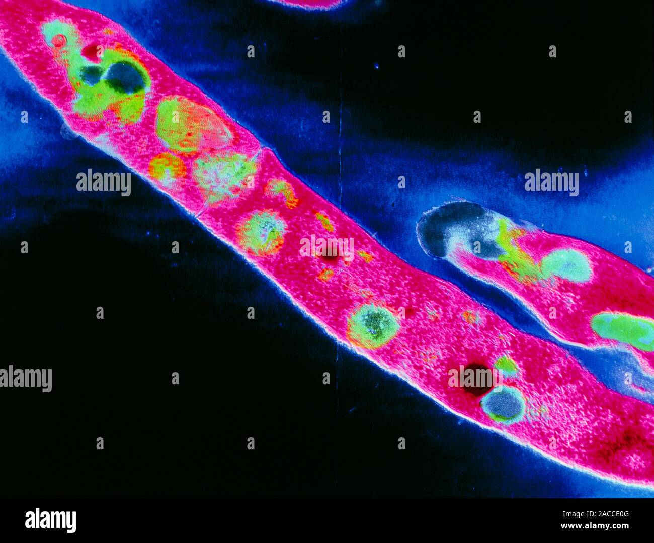 False Colour Transmission Electron Micrograph Tem Of The Bacterium Mycobacterium Tuberculosis