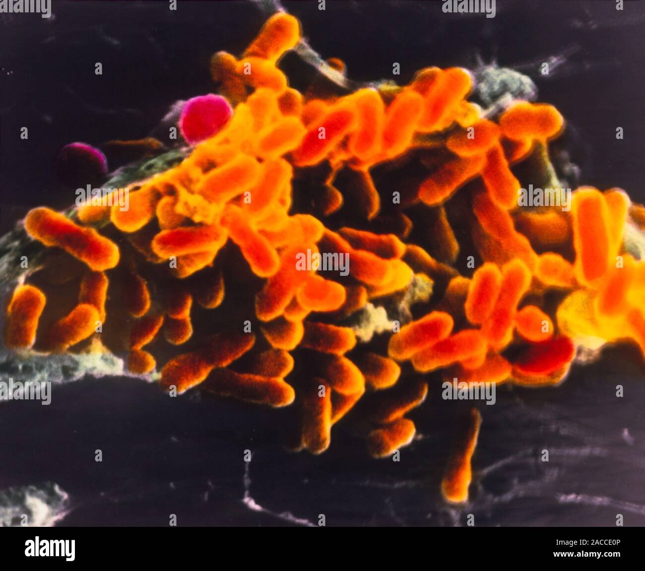 Scanning electron micrograph (SEM) of a colony of bacteria Rickettsia ...