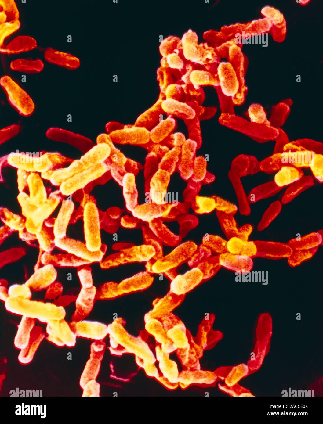 False-colour scanning electron micrograph (SEM) of a cluster of ...