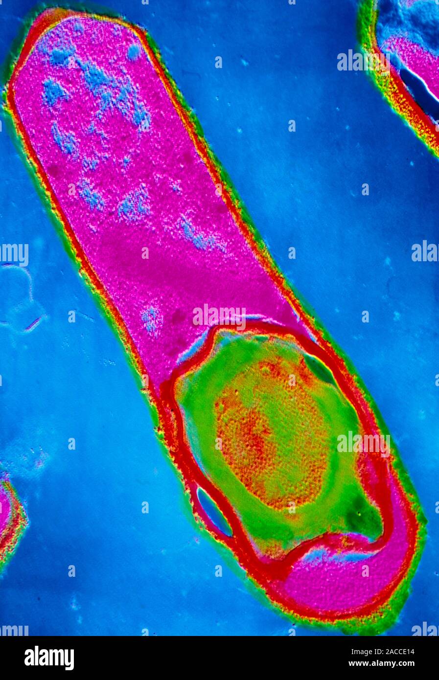 False-colour transmission electron micrograph (TEM) of a Clostridium ...