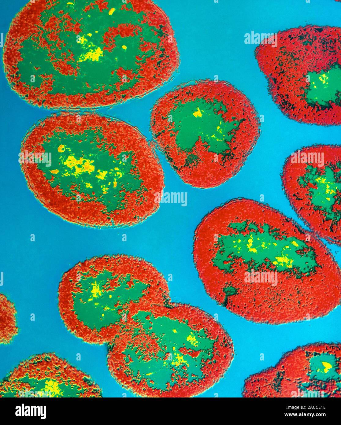 False-colour transmission electron micrograph of Neisseria meningitidis ...