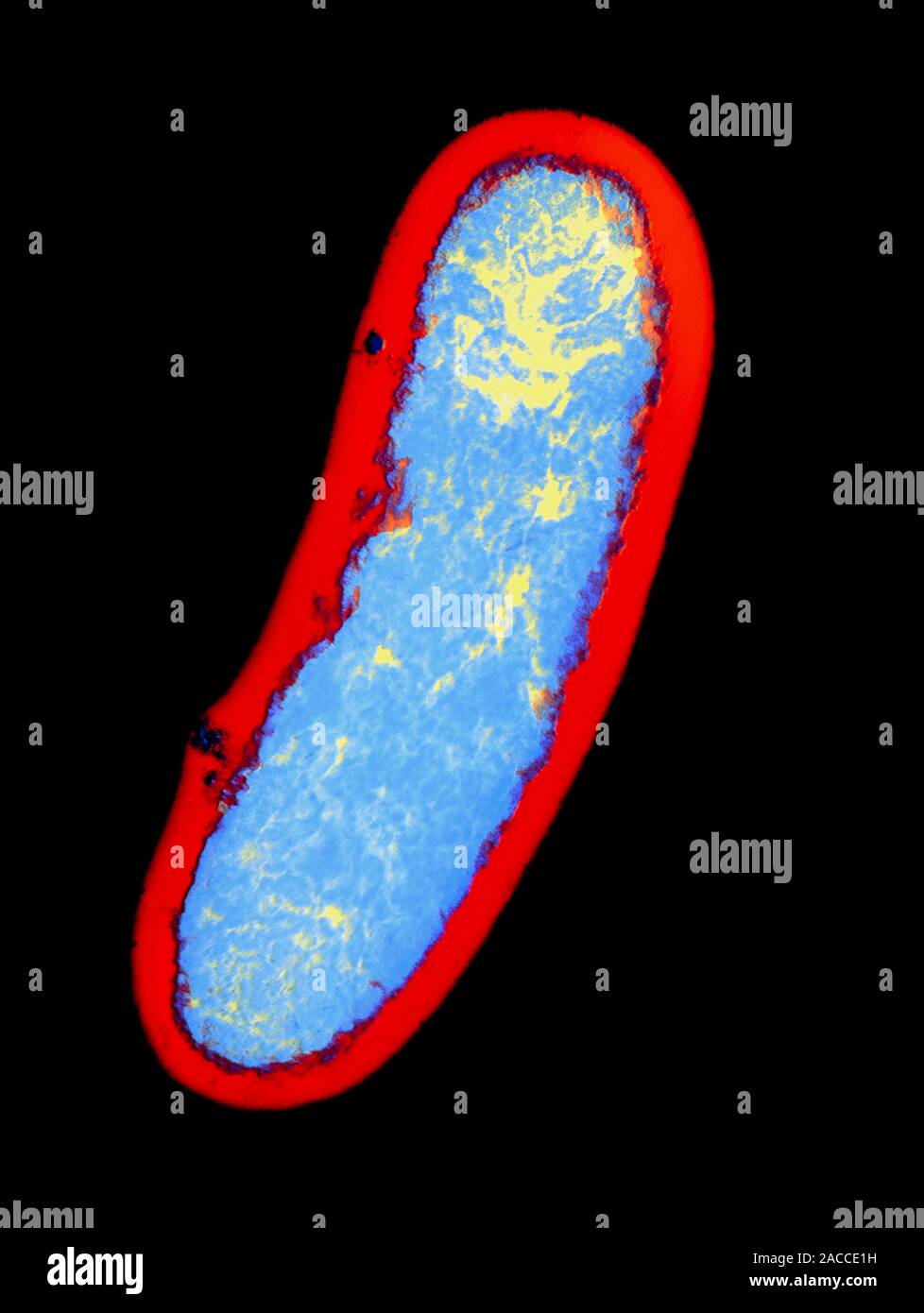 False-colour transmission electron micrograph of Yersinia pestis (blue ...
