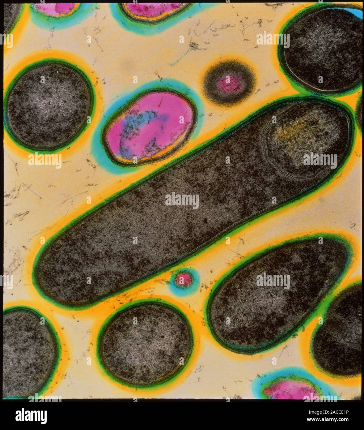 Coloured transmission electron micrograph (TEM) of Clostridium ...