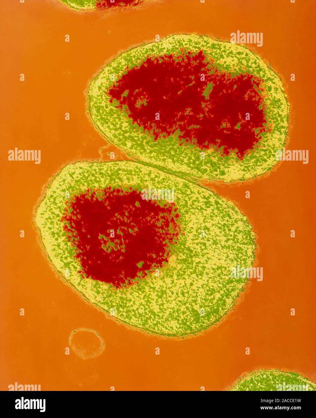 False-colour transmission electron micrograph of Neisseria meningitidis ...