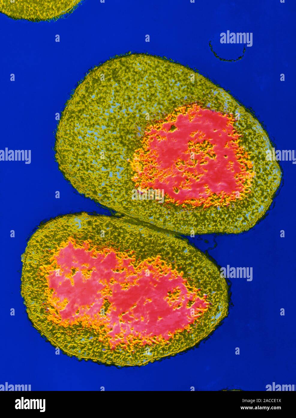 False-colour transmission electron micrograph of Neisseria meningitidis ...