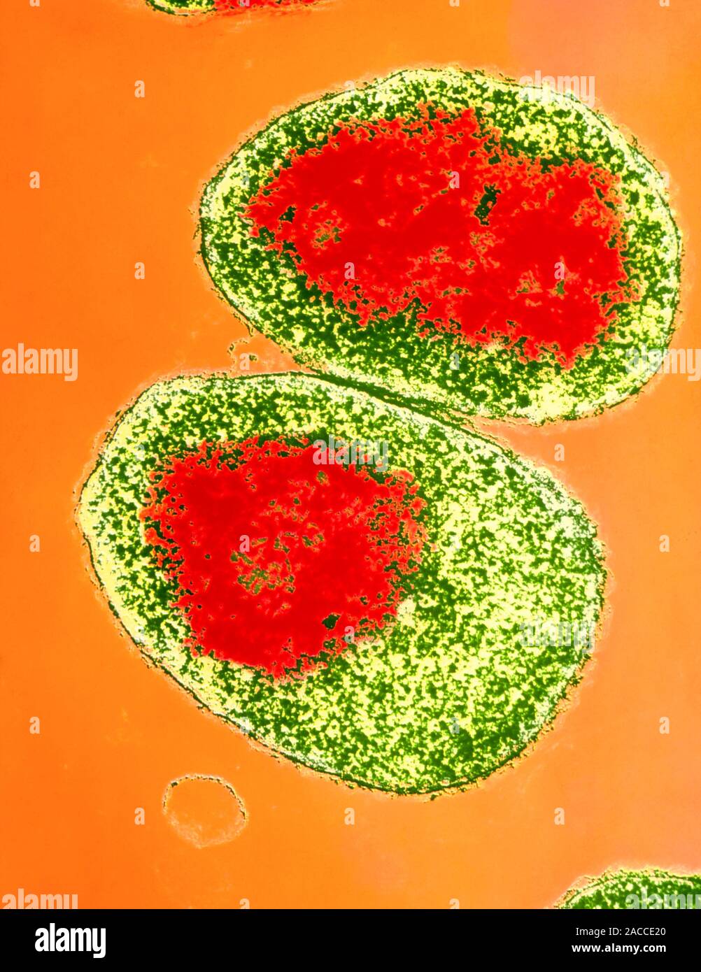 False-colour transmission electron micrograph of Neisseria meningitidis ...
