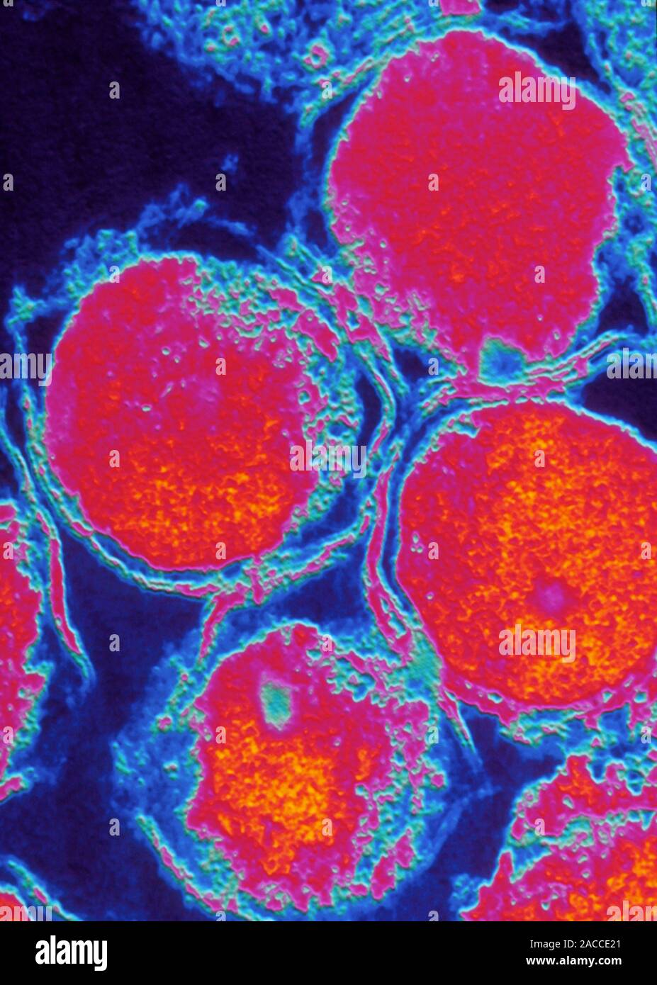 Chlamydia trachomatis. False-colour transmission electron micrograph ...