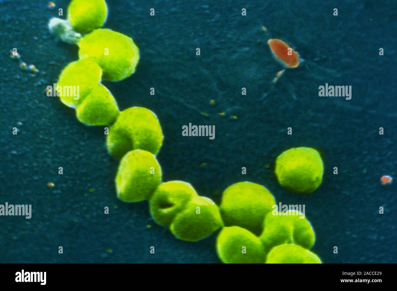 False-colour scanning electron micrograph (SEM) of Neisseria ...