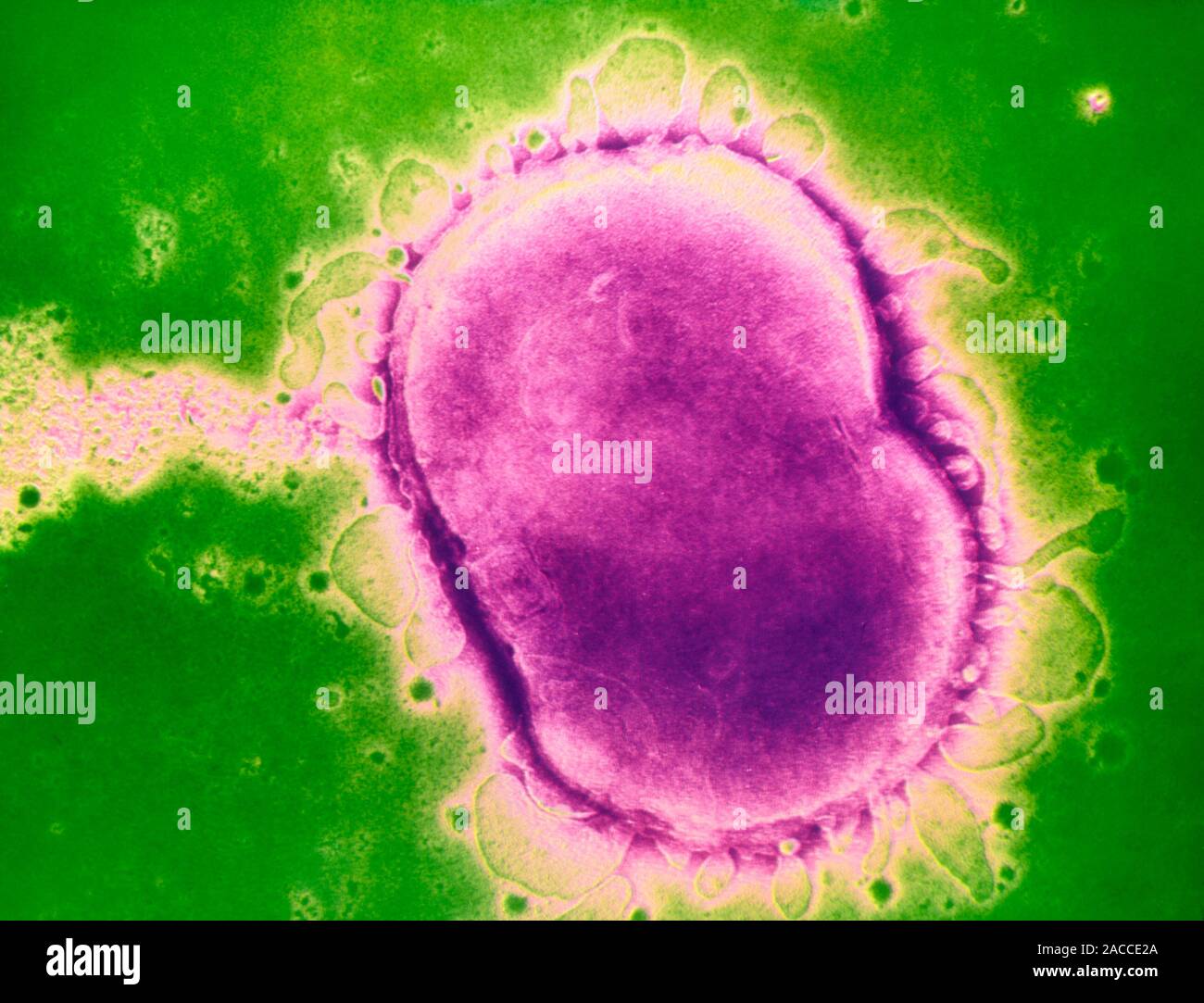False-colour transmission electron micrograph of Neisseria meningitidis ...
