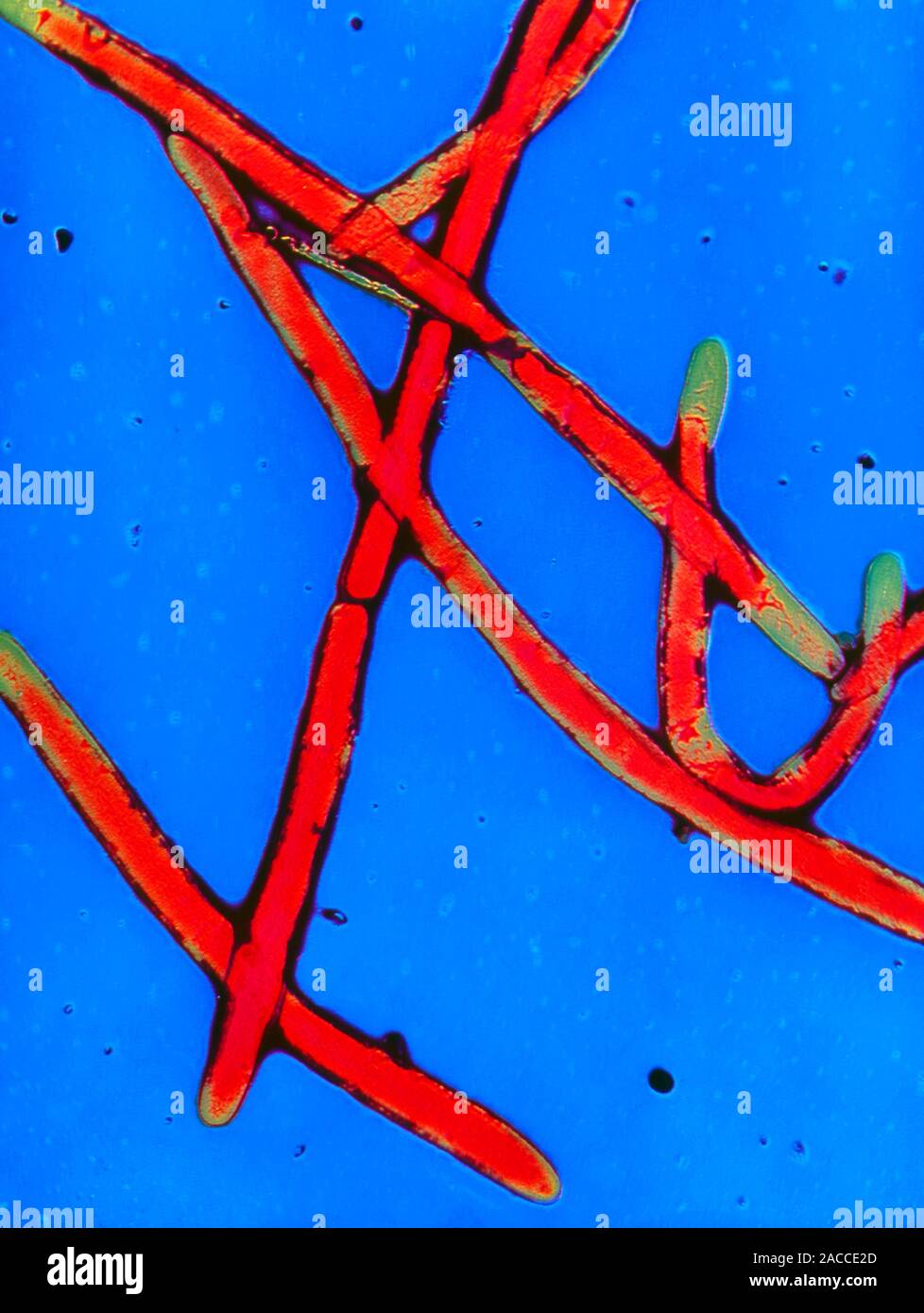 Coloured transmission electron micrograph of a group of Fusobacterium ...