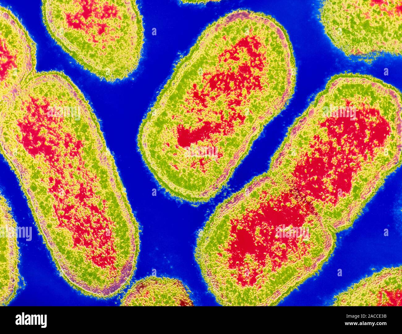 Coloured transmission electron micrograph of the bacteria Bacteroides ...